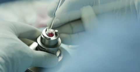 Eye Banking - Eyesight International