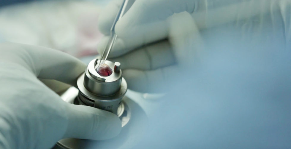 Eye Banking - Eyesight International