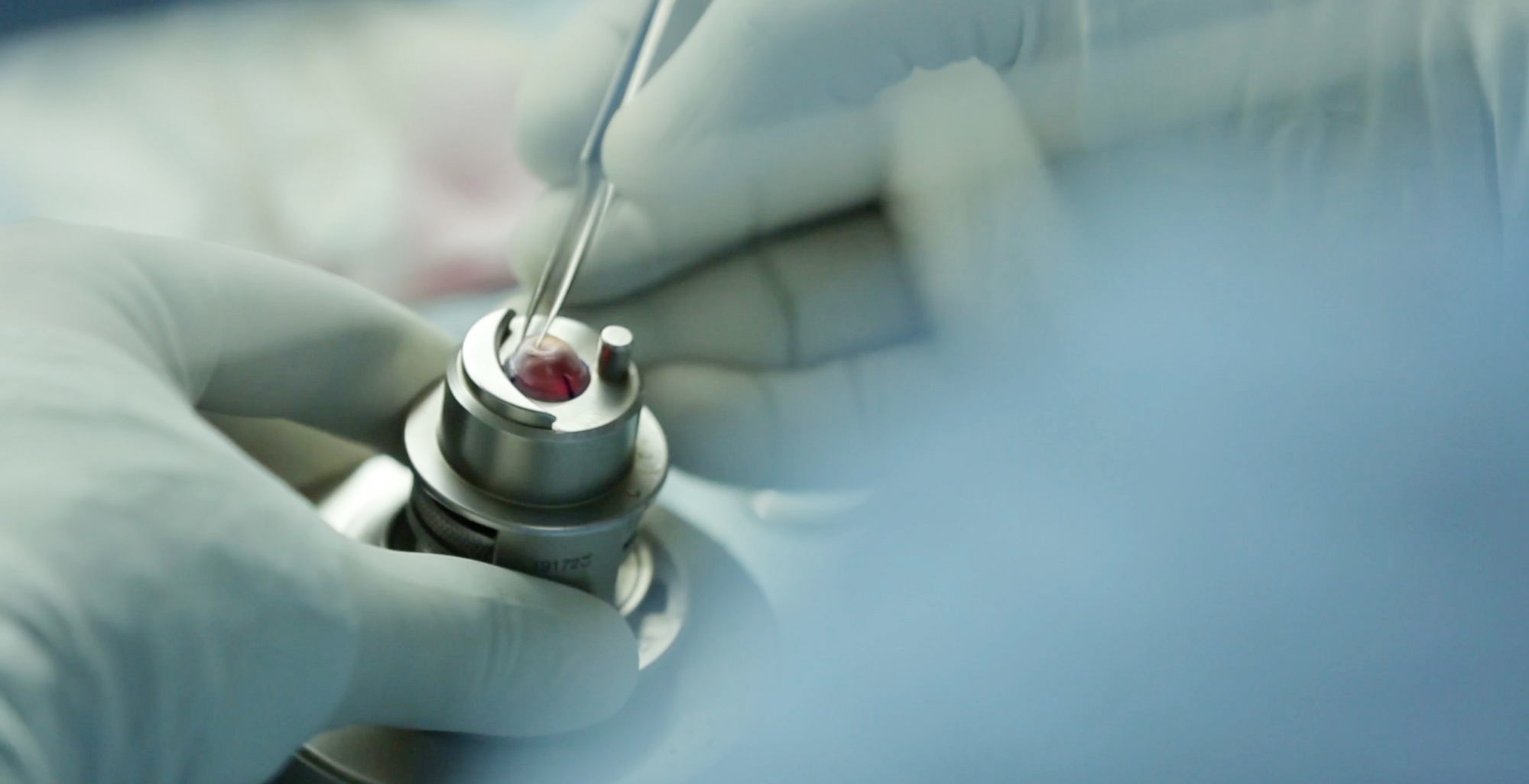 Eye Banking - Eyesight International